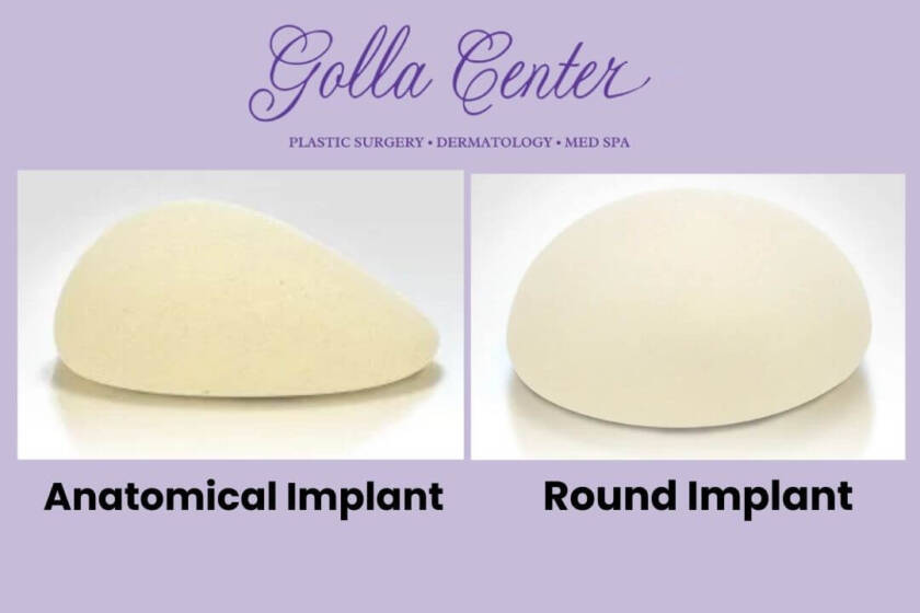 Breast Augmentation Pittsburgh PA | Board-Certified Surgeon Dr. Golla
