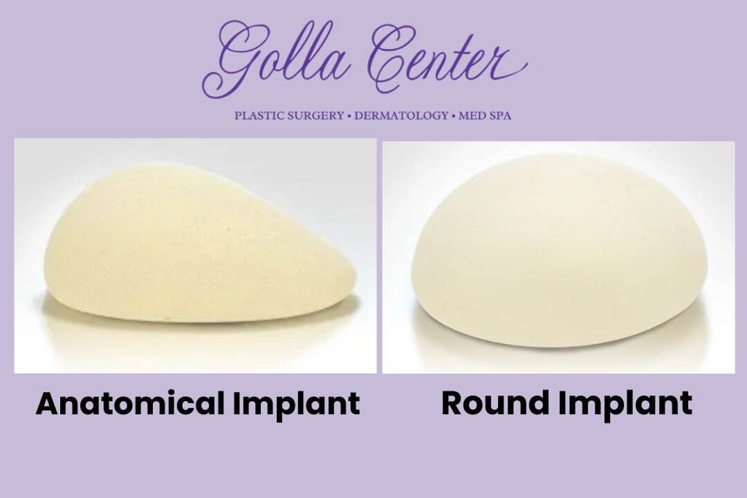 Breast Augmentation Pittsburgh PA | Board-Certified Surgeon Dr. Golla